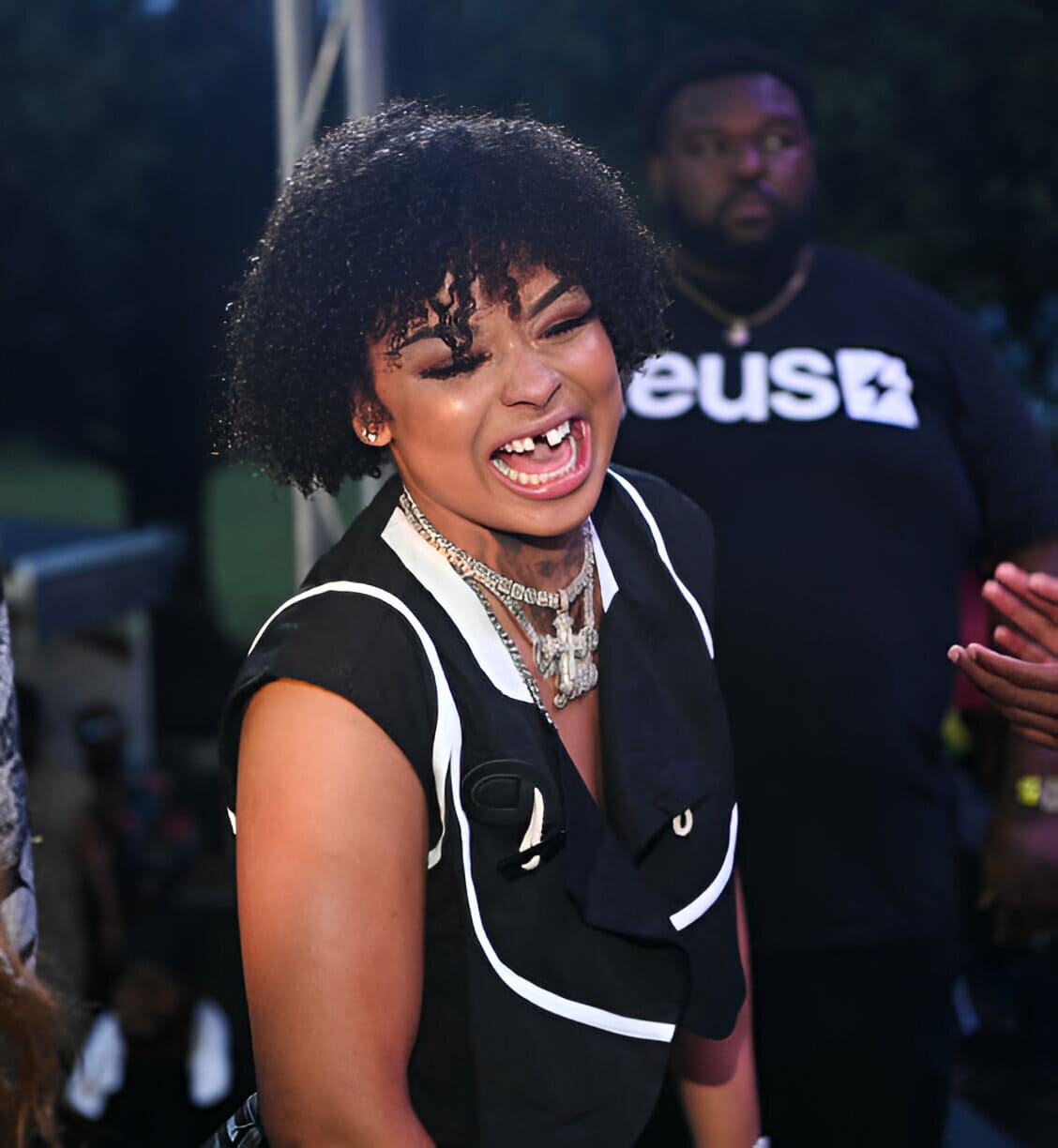How did Chrisean Rock lose her tooth?
